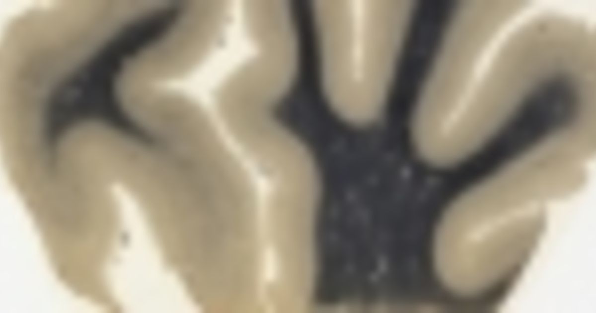 What Does Einstein's Brain Look Like? | Ad Age