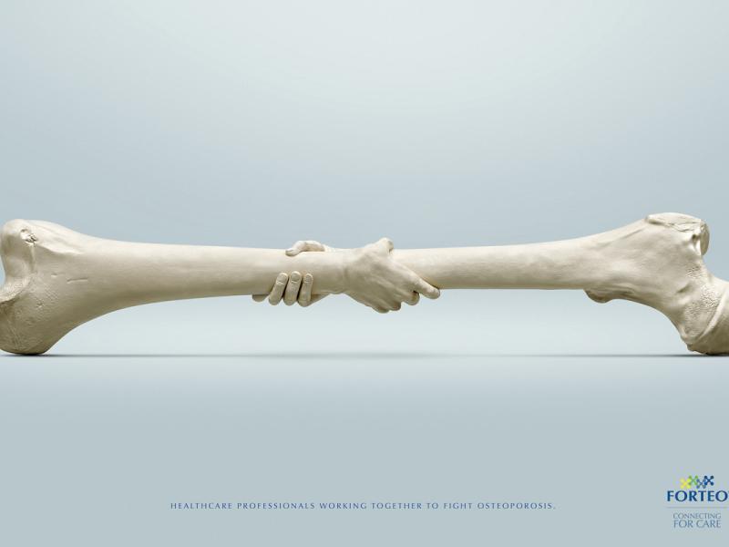 Eli Lilly: Forteo. Connecting for Care. | Ad Age