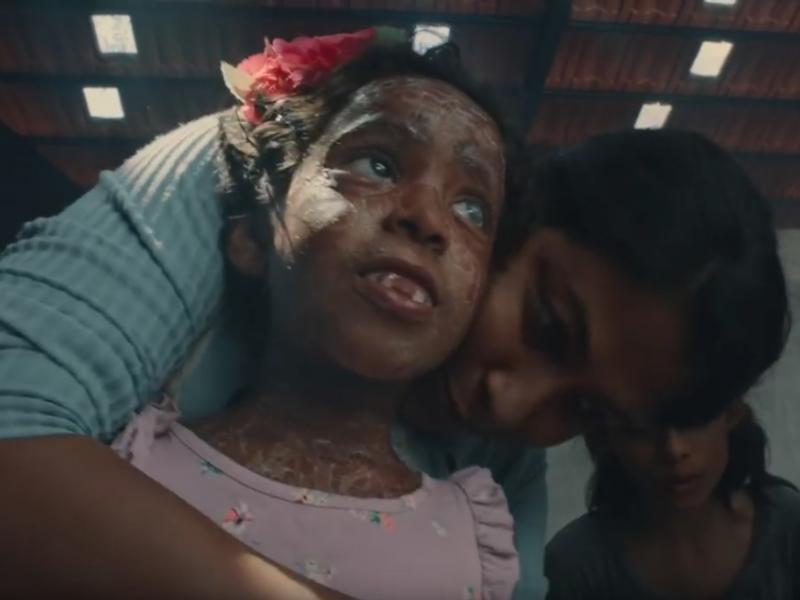 A girl with a rare skin condition is the subject of Vicks' powerful ...